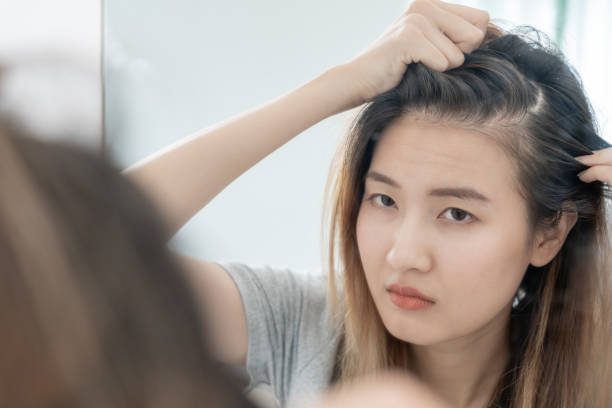 Wajib Tahu! Ini Faktor Penyebab Rambut Beruban di Usia Muda - Pantau.com